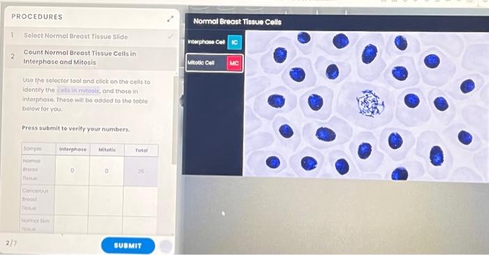 PROCEDURES 1 Select Normal Breast Tissue Slide Count | Chegg.com