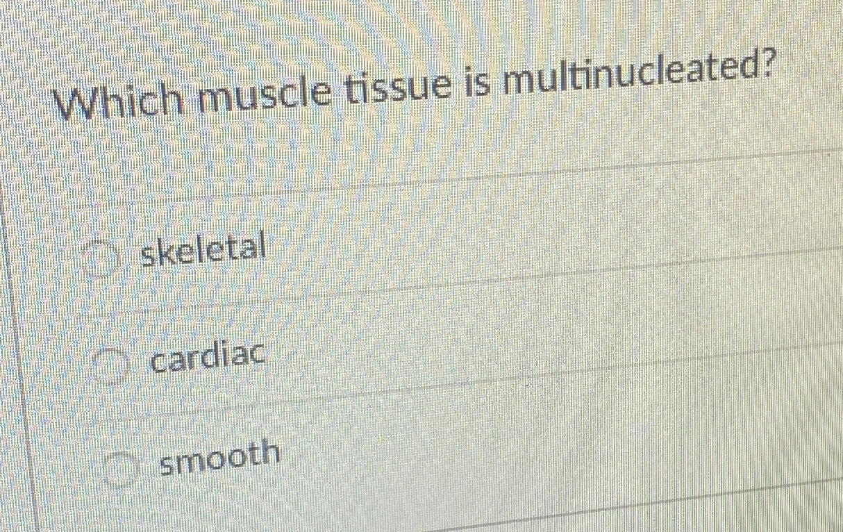 Solved Which muscle tissue is | Chegg.com