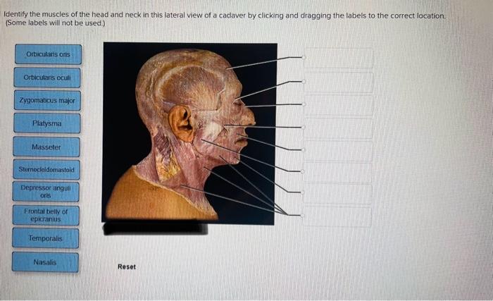 Solved Identify the muscles of the head and neck in this | Chegg.com