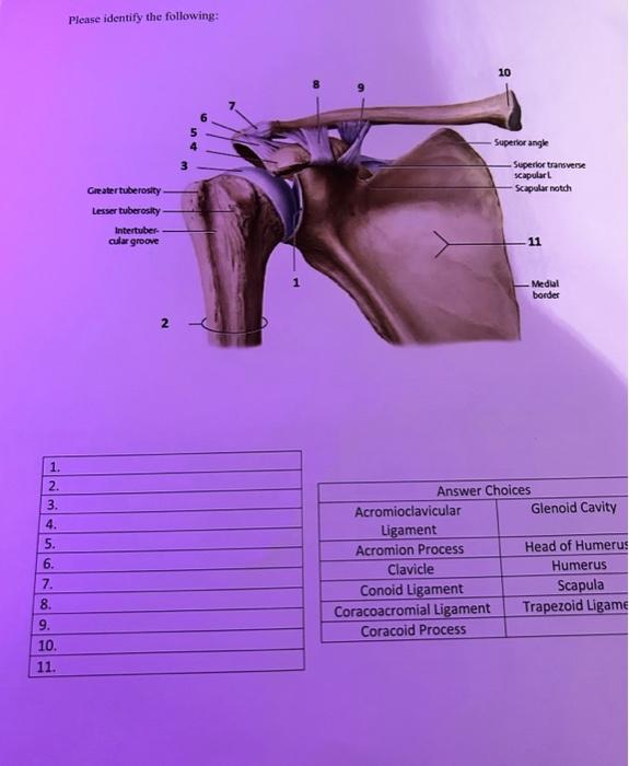 Solved Upper Extremity Anatomy (word banks under answer | Chegg.com