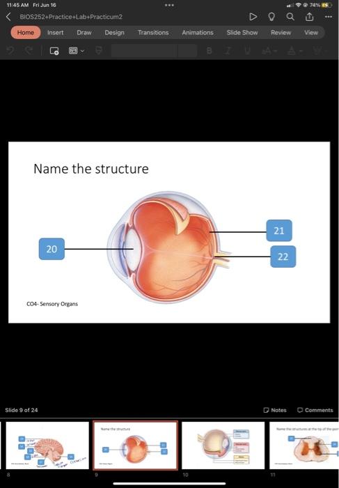 Solved Name the structures at the tip of the pointers | Chegg.com