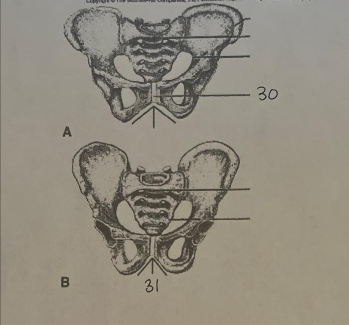 Solved Bone List Atlas Axis dens Acetabulum Acromion process | Chegg.com