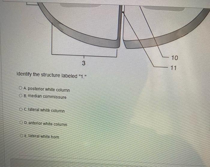 Solved Identify the structure labeled "1" A. posterior | Chegg.com
