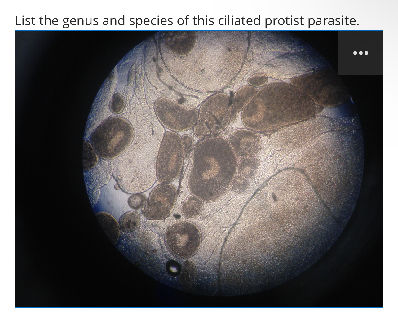 Solved List the genus and species of this ciliated protist | Chegg.com