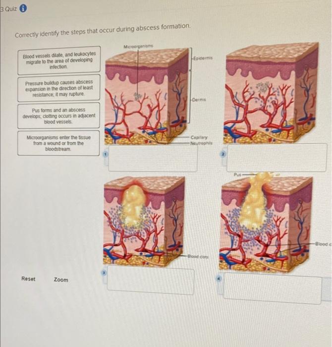 Solved 3 Quiz 0 Correctly identify the steps that occur | Chegg.com