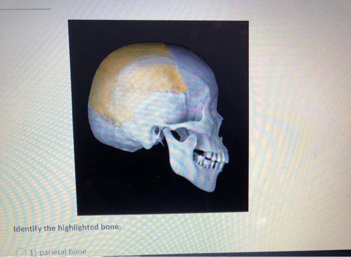 Solved Identify the highlighted bone: 1) parietal bone | Chegg.com