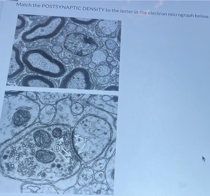 Solved Match the POSTSYNAPTIC nenicim. btter in the electron | Chegg.com