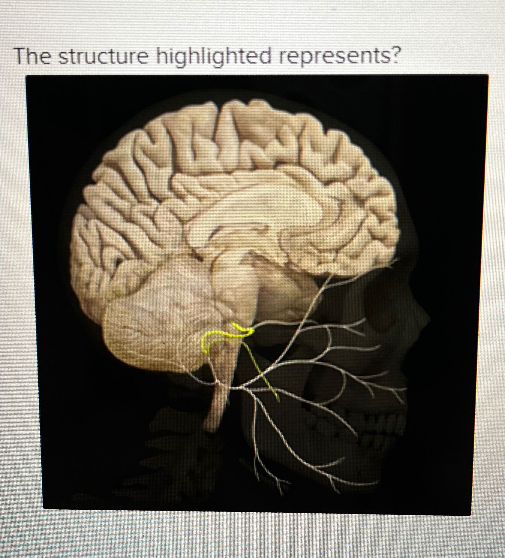 Solved The Structure highlighted represents?Multiple | Chegg.com