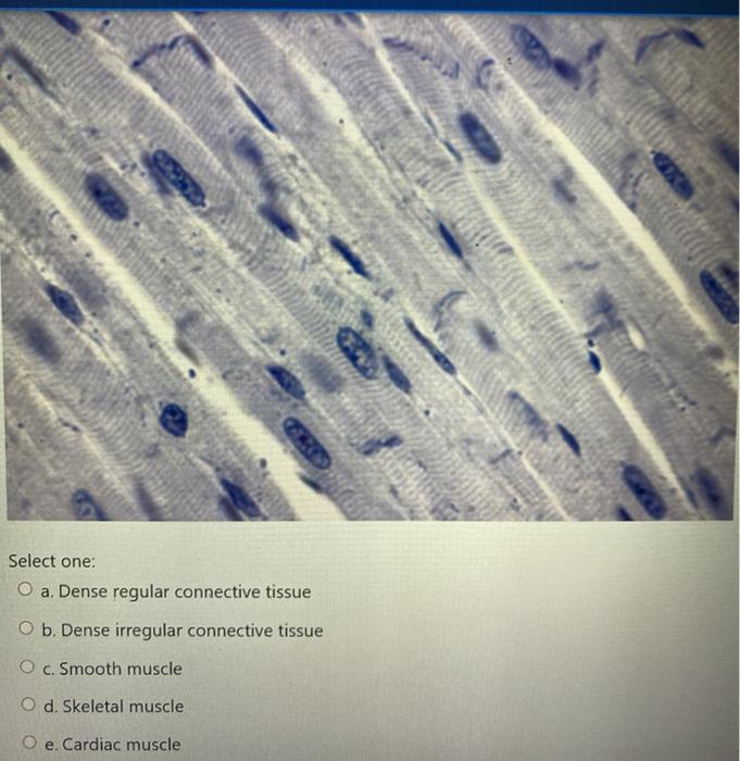 Dense Regular Connective Tissue Vs Smooth Muscle