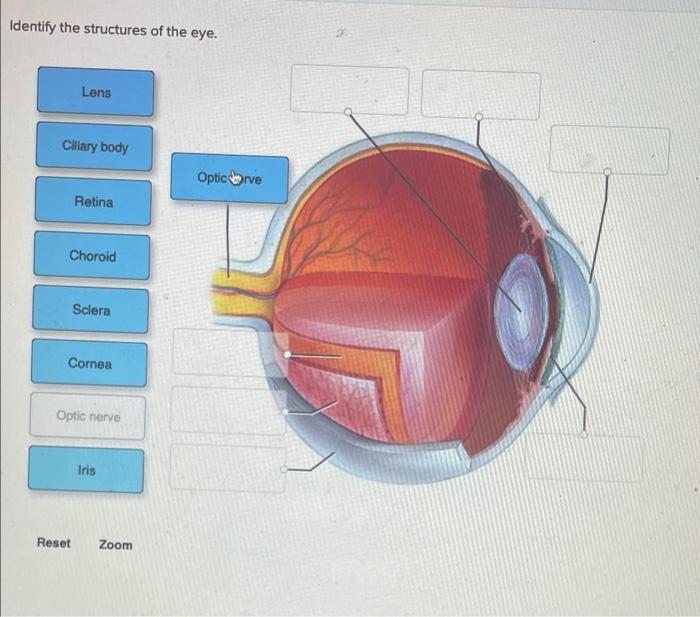 Solved Identify the structures of the eye. Lens Ciliary body | Chegg.com
