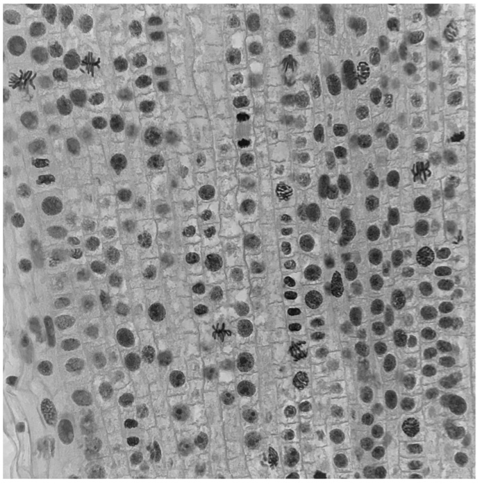 Solved count number of cells in each stage interphase, | Chegg.com