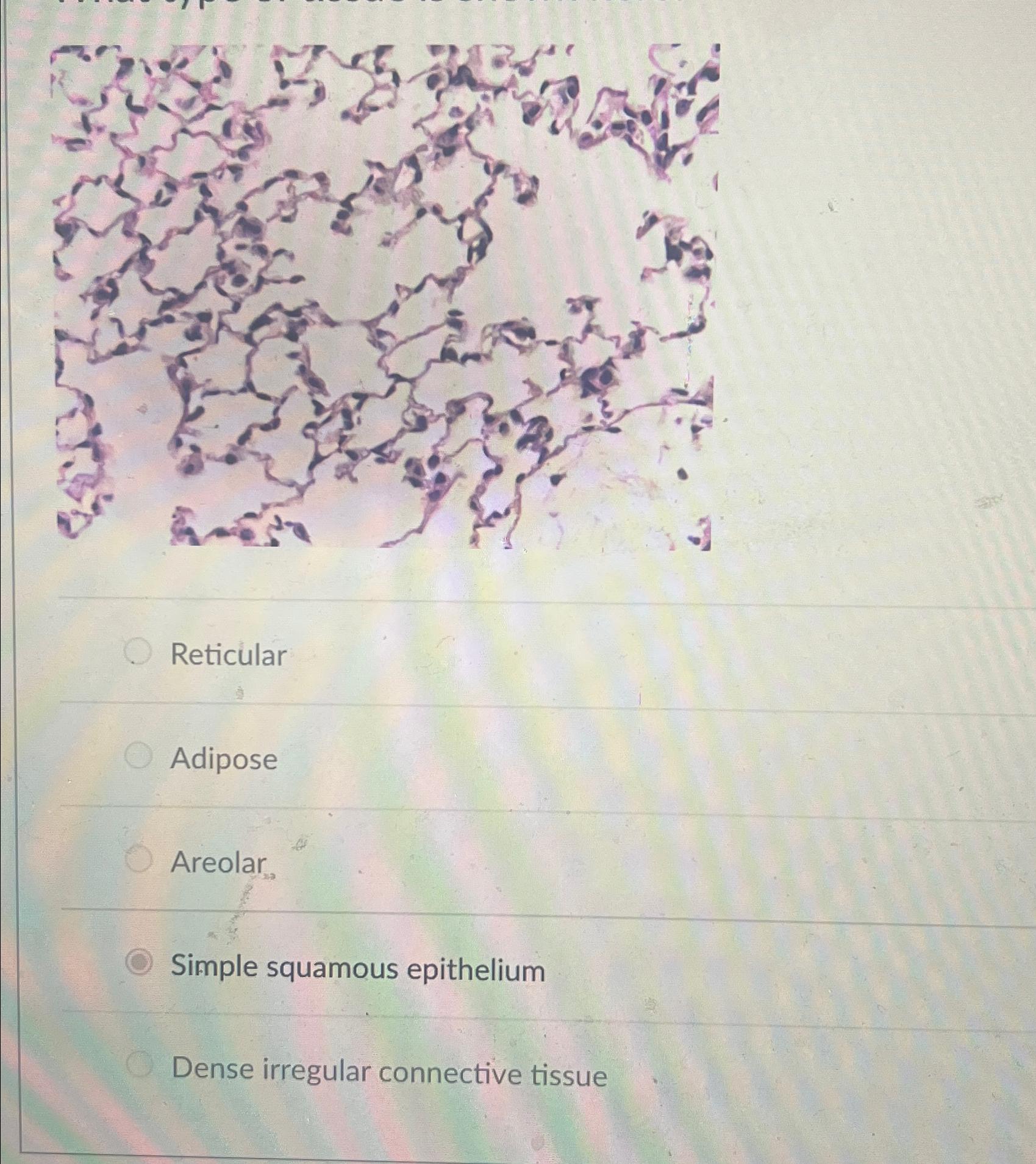 Solved ReticularAdiposeAreolarSimple squamous | Chegg.com
