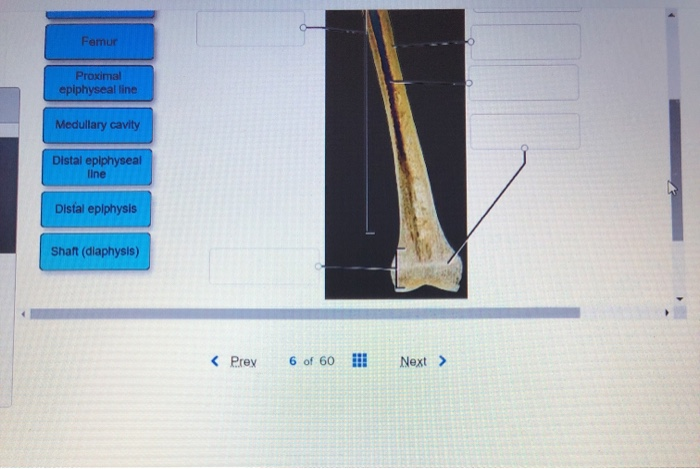 Solved Label the structures of the bone. Proximal epiphysis | Chegg.com