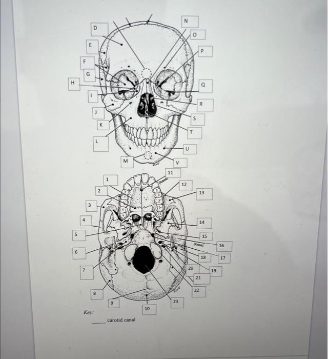 Solved Using choices from the key on the next page, identify | Chegg.com