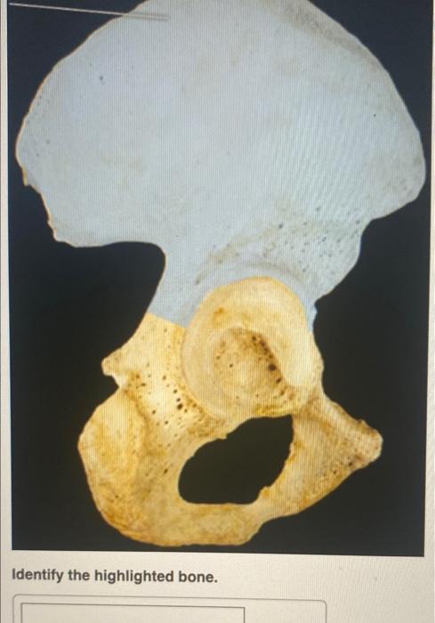 Solved 1. what is the highlighted bone?2. what is the | Chegg.com