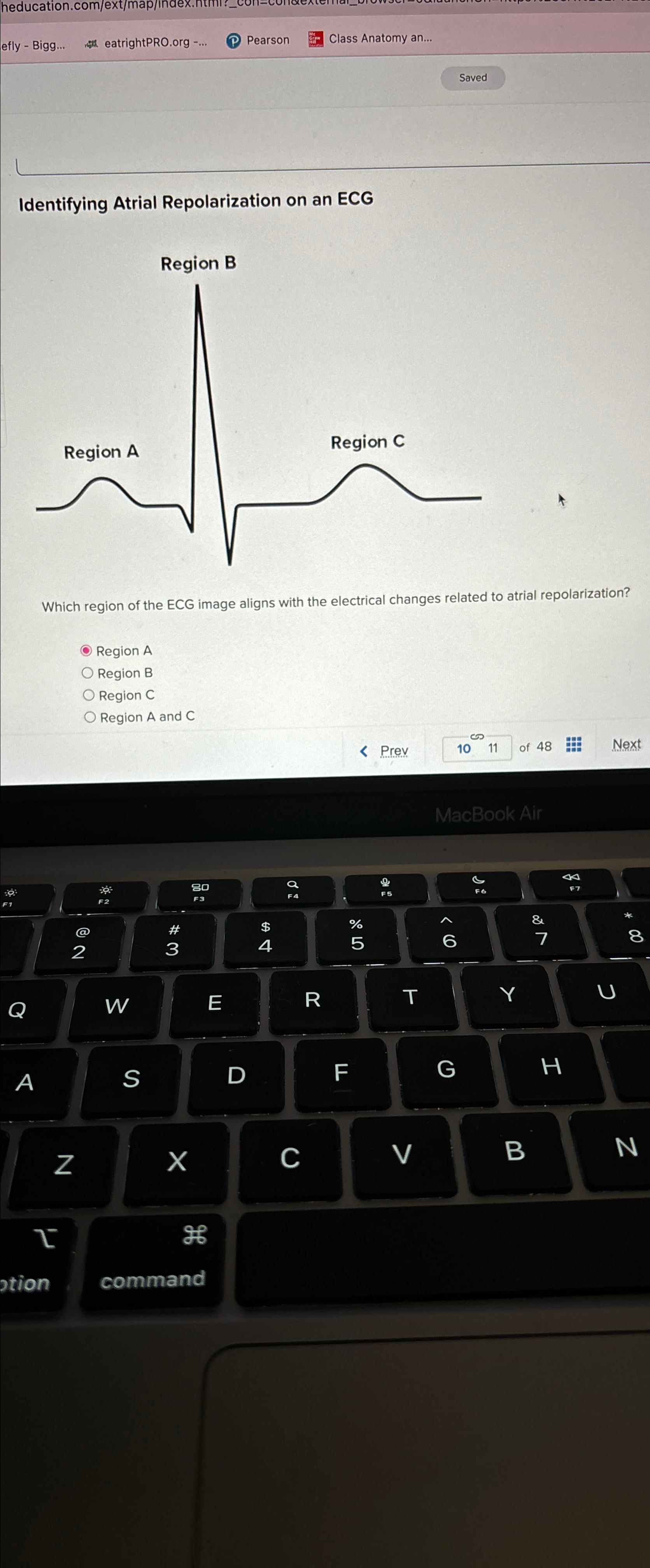 Solved Identifying Atrial Repolarization on an ECGWhich | Chegg.com
