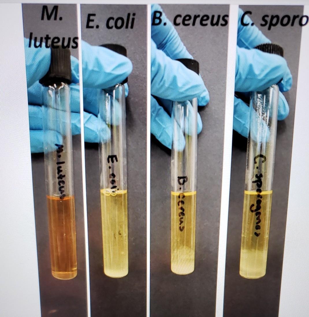 Solved M. E. coli B. cereus C. sporo luteus Miluftus. B. CAS | Chegg.com