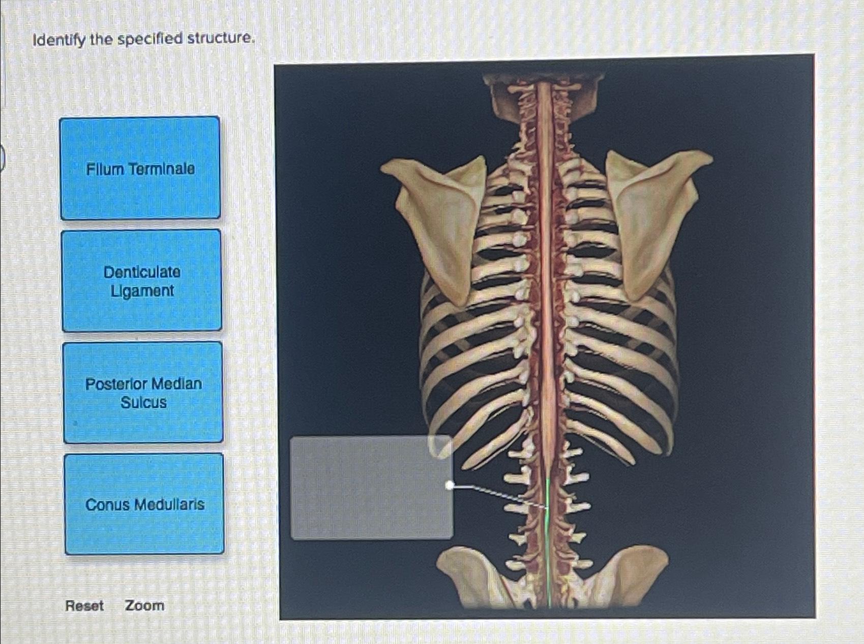 Solved Identify the specified structure. | Chegg.com