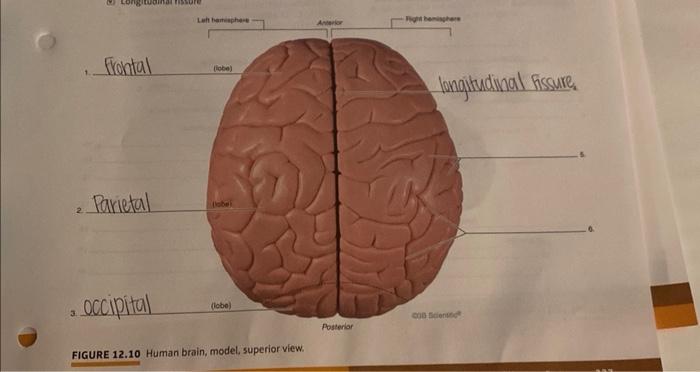 Solved FIGURE 12.10 Human brain, model, superior | Chegg.com