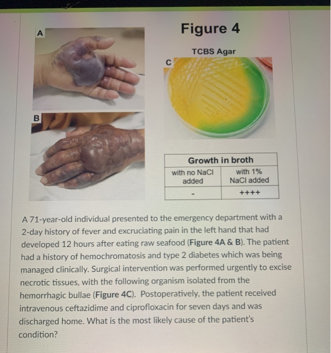 Solved А Figure 4 TCBS Agar C B Growth in broth with no NaCl | Chegg.com