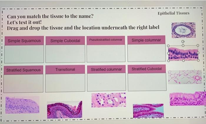 Solved Can you match the tissue to the name? Epithelial | Chegg.com