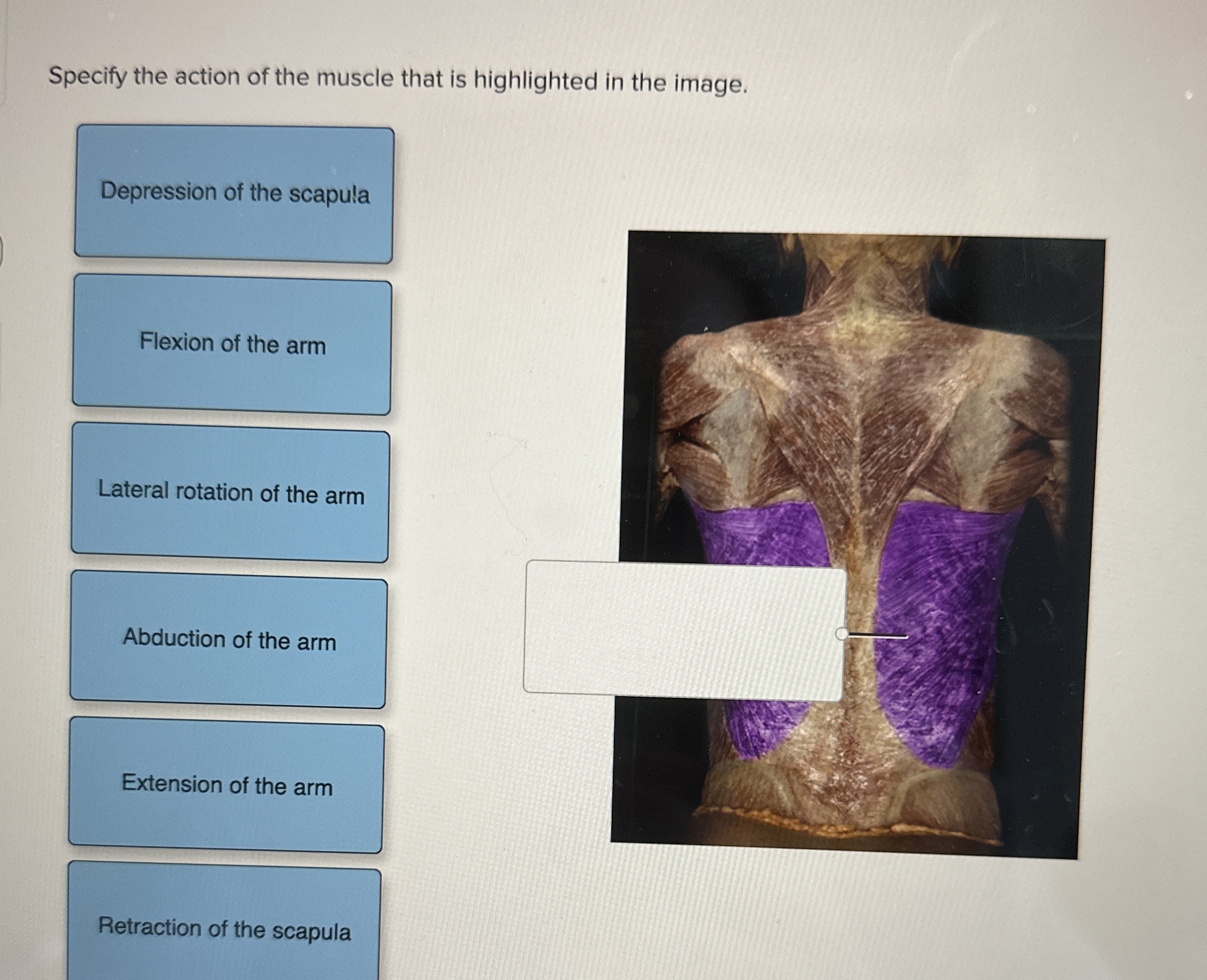 Solved Specify the action of the muscle that is highlighted | Chegg.com