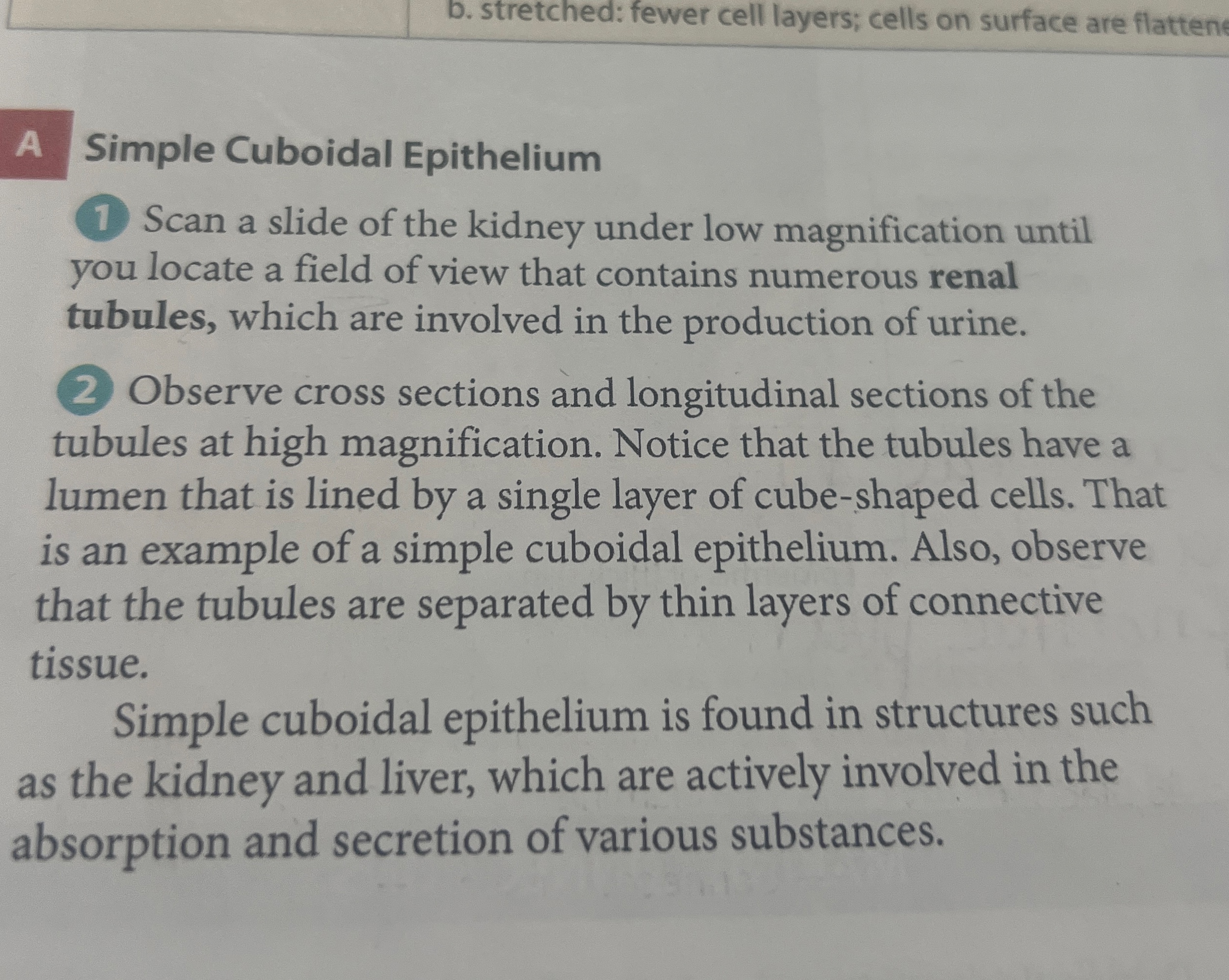 Solved Simple Cuboidal EpitheliumScan a slide of the kidney | Chegg.com
