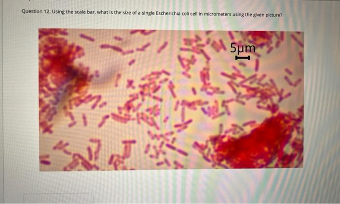 Solved Question 12. Using the scale bar, what is the size of | Chegg.com