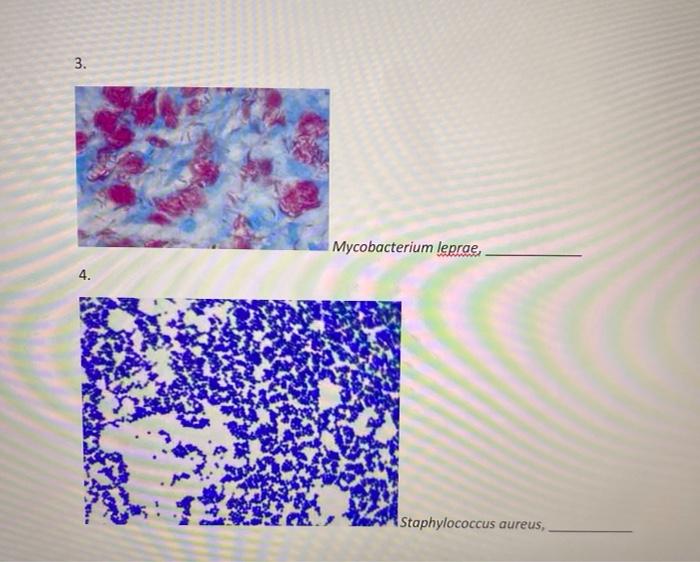 Solved A. Observe the following micrographs and determine if | Chegg.com Solved A. Observe the following micrographs and determine if | Chegg.com