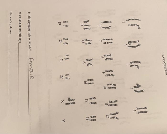 Solved \r\nIs this karyotype male or female? Kind of error | Chegg.com