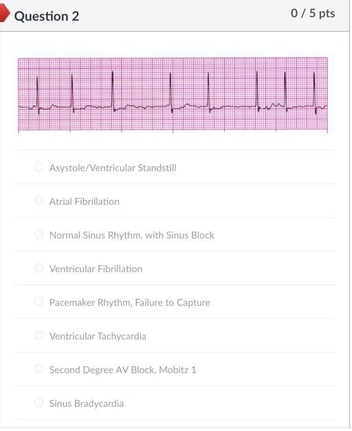 Solved Question 2 0/5 pts Asystole/Ventricular Standstill | Chegg.com