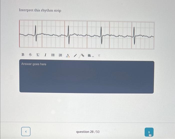 Interpret this rhythm strip Interpret this rhythm | Chegg.com