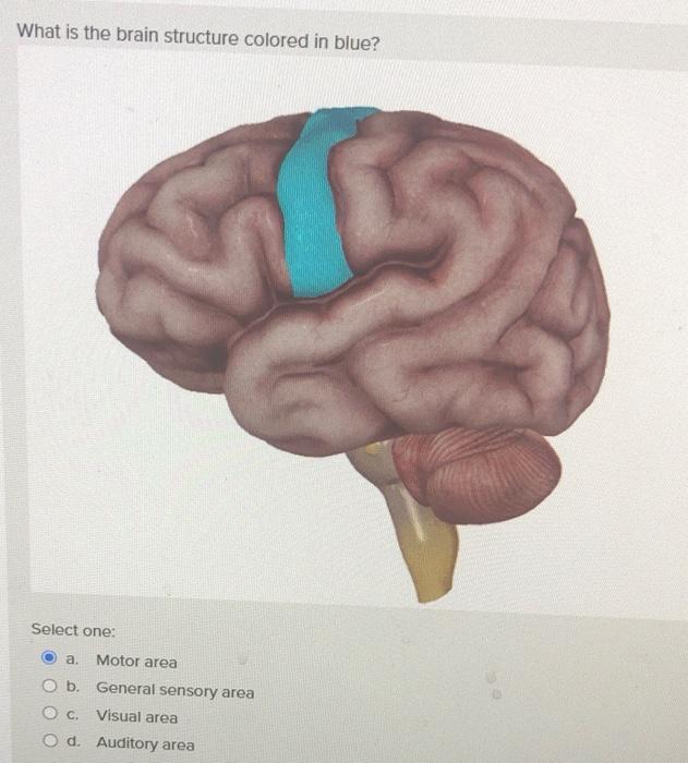 Solved What is the brain structure is colored in blue? | Chegg.com