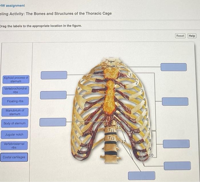 Solved HW assignment eling Activity: The Bones and | Chegg.com
