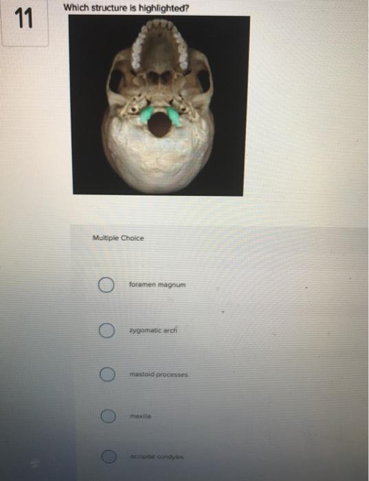 Solved Which structure is highlighted? 11 Multiple Choice | Chegg.com