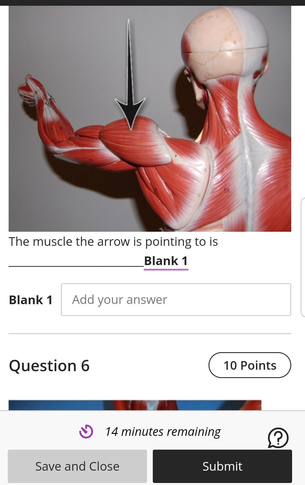 Solved The muscle the arrow is pointing to is Blank 1 Blank | Chegg.com