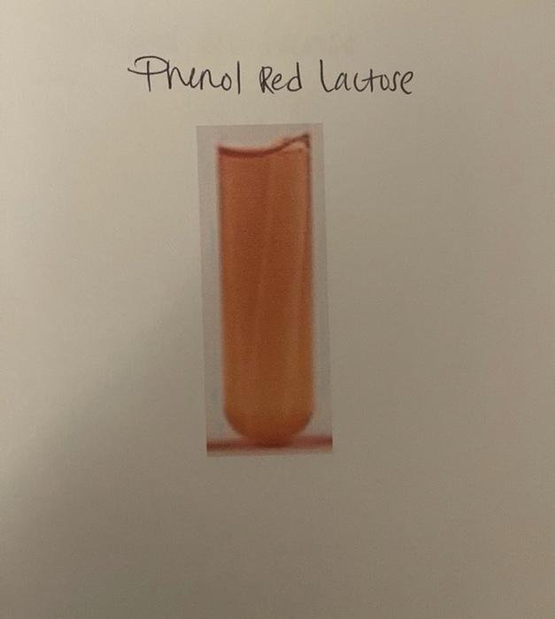 Solved The phenol red broth control Compare to the control | Chegg.com