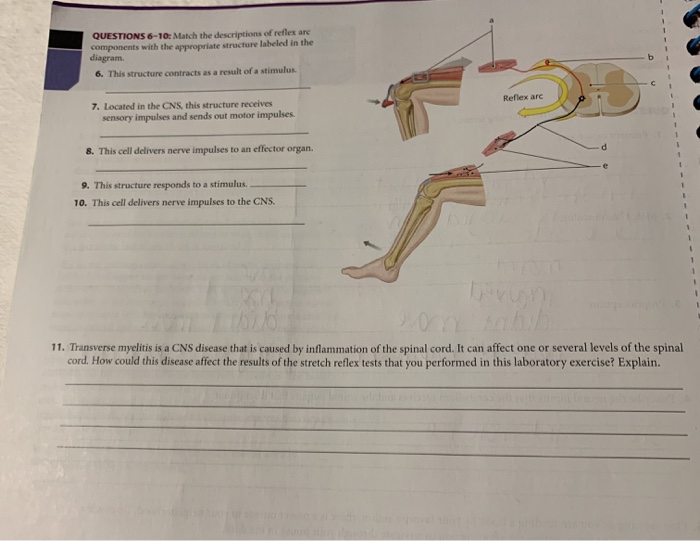 QUESTIONS 6-10: Match the descriptions of reflex are | Chegg.com