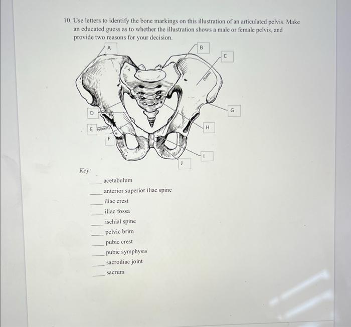 Solved Bones of the Pelvic Girdle and Lower Limb 7. Compare | Chegg.com