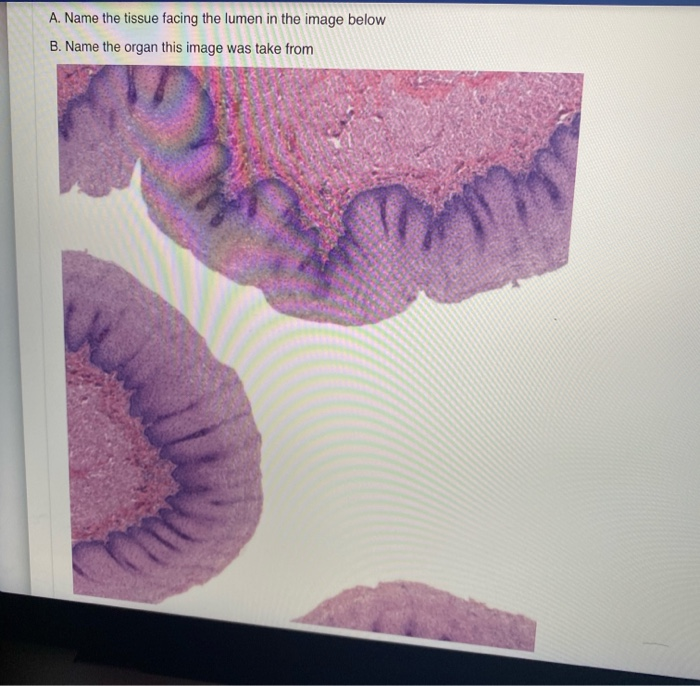 Solved A. Name the tissue facing the lumen in the image | Chegg.com