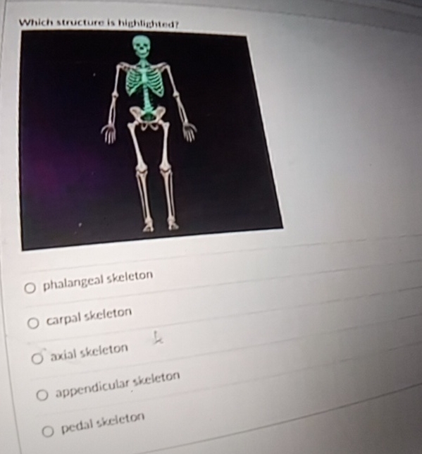 Solved Which structure is hightighted?phalangeal | Chegg.com