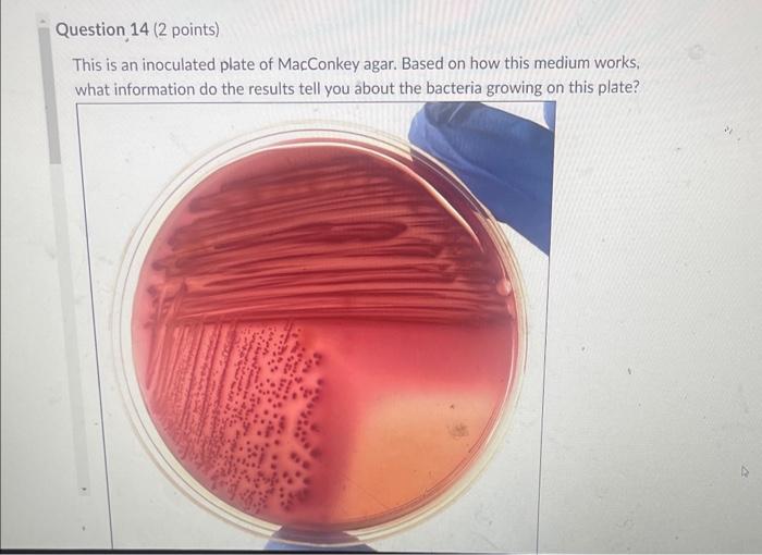 Solved This is an inoculated plate of MacConkey agar. Based | Chegg.com