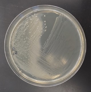 Solved what is the result of this nutrient agar test? | Chegg.com