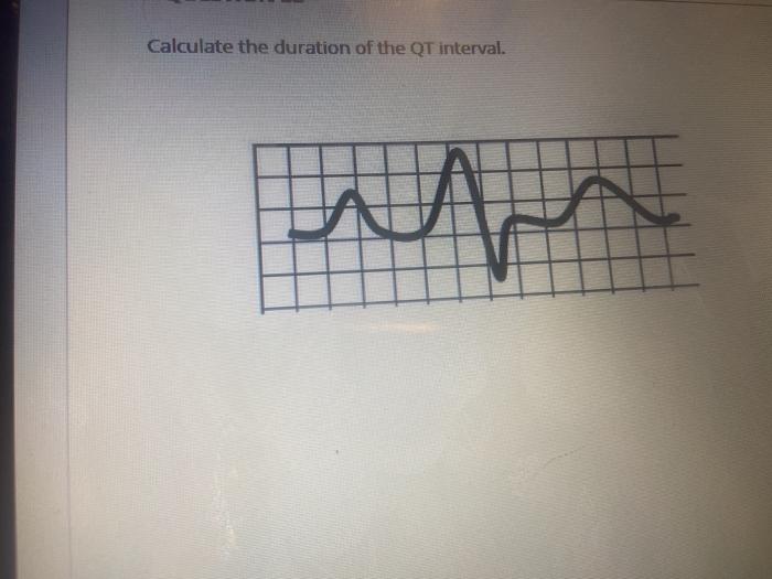 Solved Calculate the duration of the QT interval. wh | Chegg.com