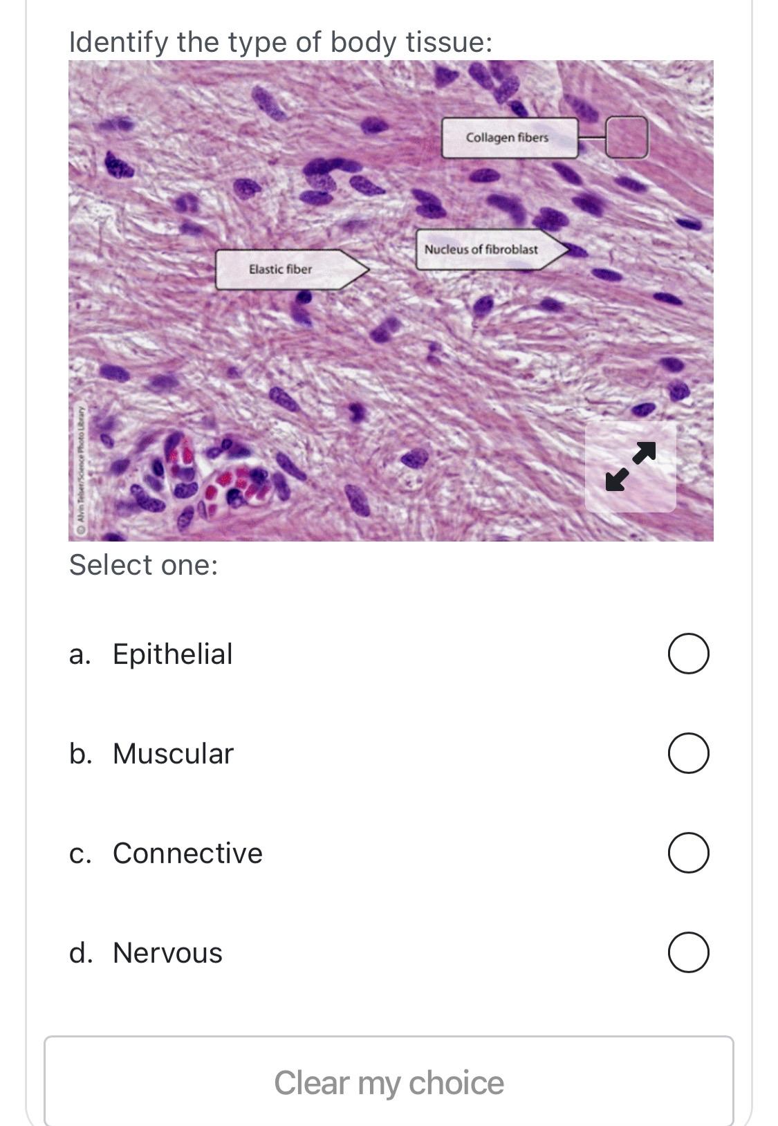 Solved Identify the type of body tissue:Select one:a. | Chegg.com