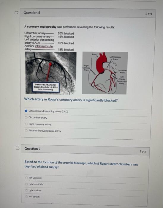Solved Question 6 A coronary angiography was performed, | Chegg.com