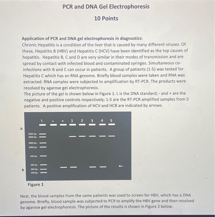 Solved Application of PCR and DNA gel electrophoresis in | Chegg.com