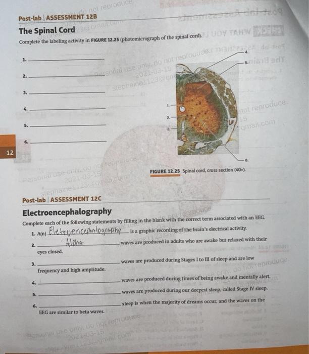 Solved Morera Post-lab ASSESSMENT 12B The Spinal Cordima | Chegg.com