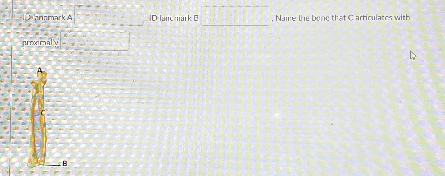 Solved ID landmark A , ﻿ID landmark E , ﻿Name the bone that | Chegg.com