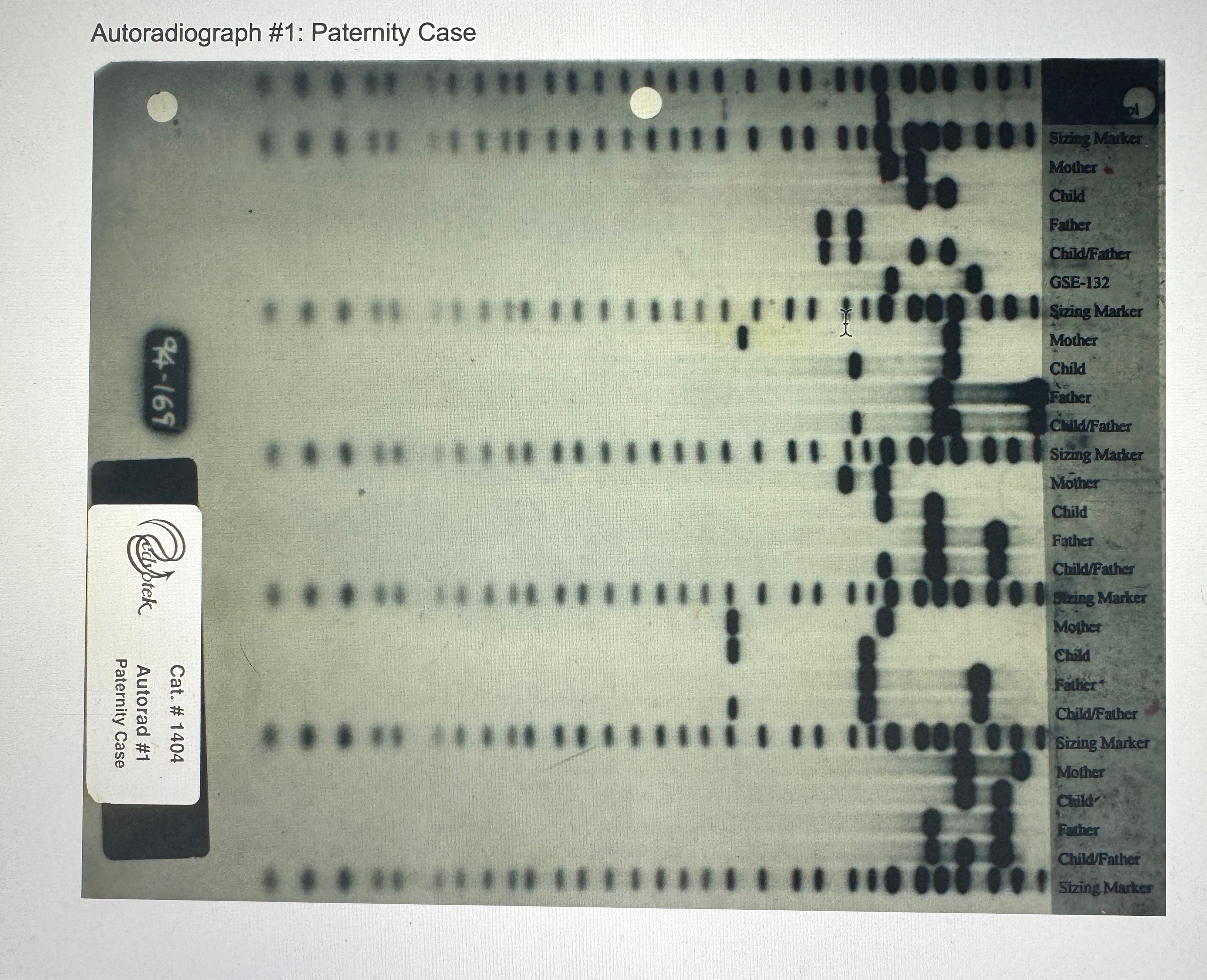 Solved Autoradiograph #1: Paternity Case 1) ﻿explain which | Chegg.com